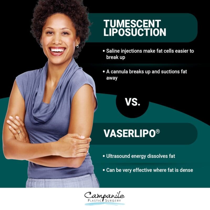 Tumescent Liposuction [Infoghraphic]